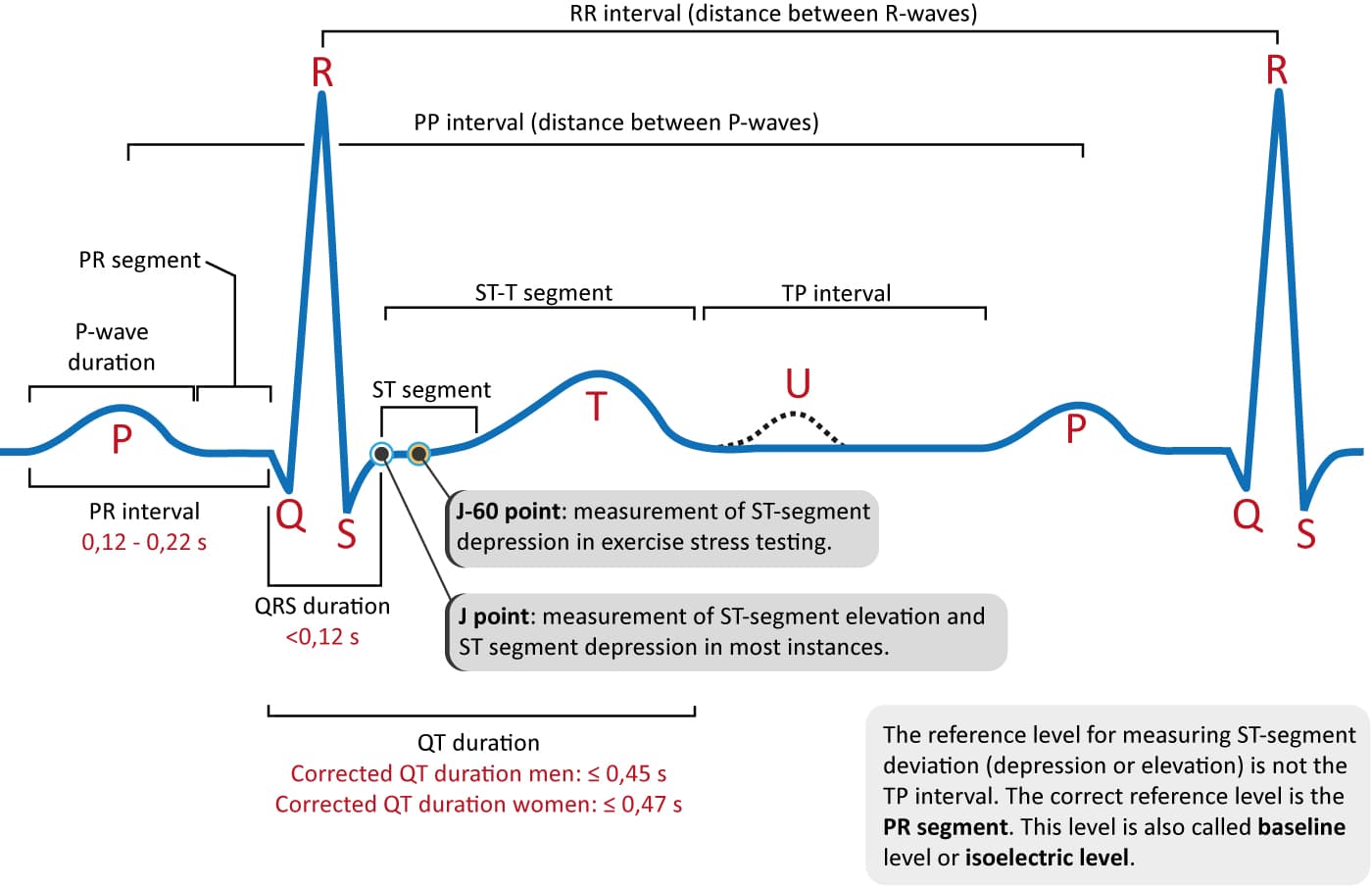 ECG Normal Range for R Wave in V5 and S Wave in V1